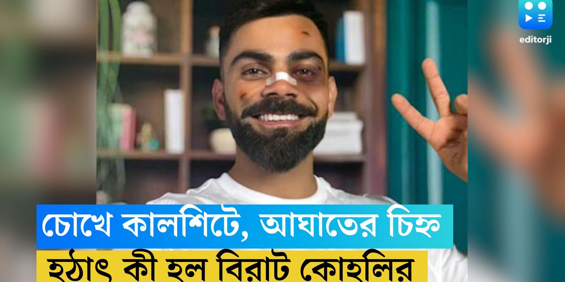 Virat Kohli shares his injured picture in Instagram story - Virat Kohli ...