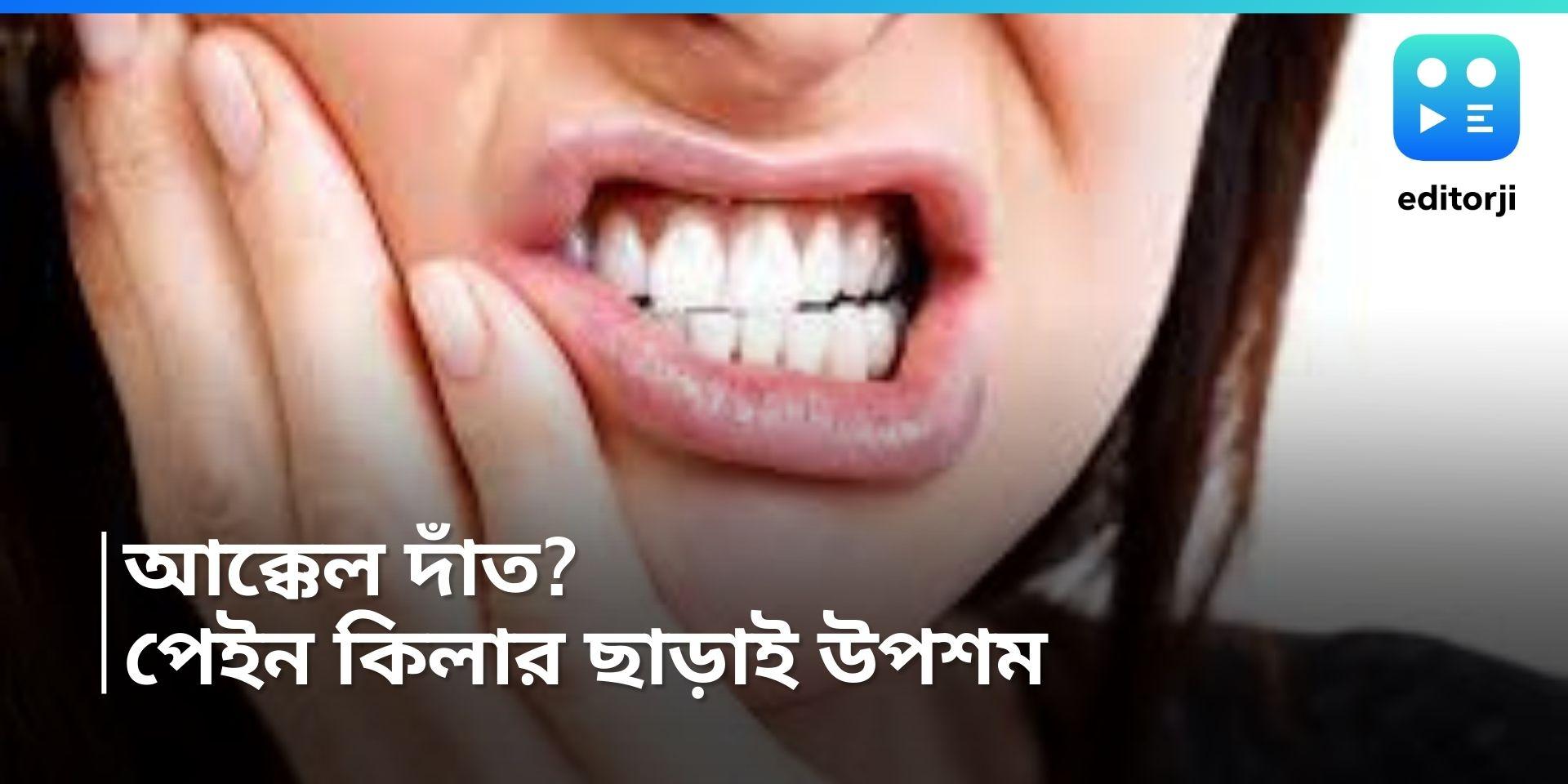 how to get rid of tooth ache? - Tooth Pain: অসম্ভব দাঁতের ব্যথা? টপাটপ ...