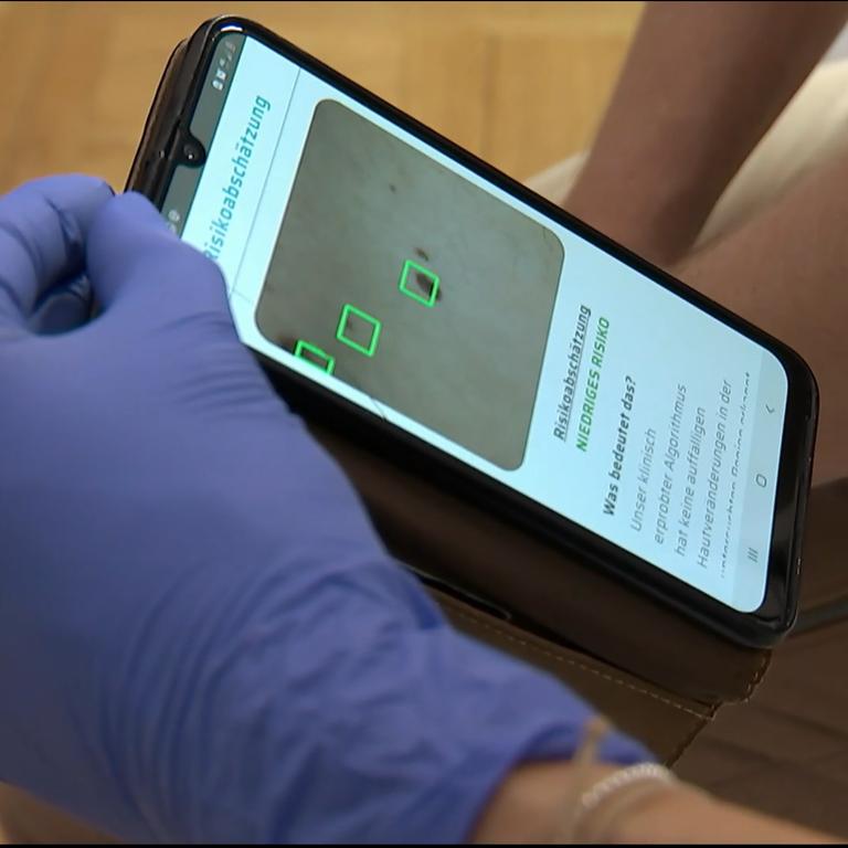 Detecting skin cancer via app | Editorji