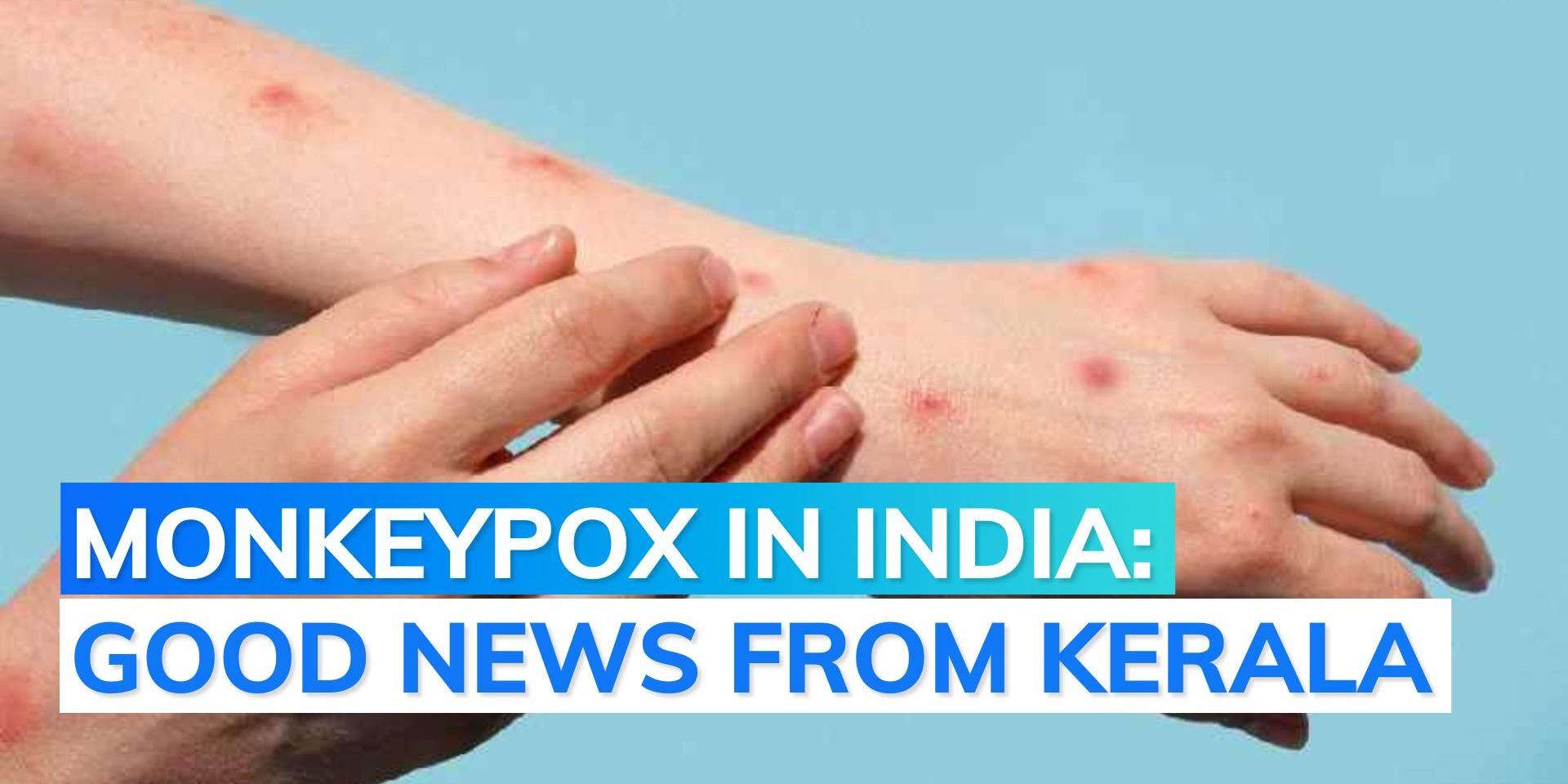 Monkeypox News: India‘s first monkeypox patient from Kerala recovers ...