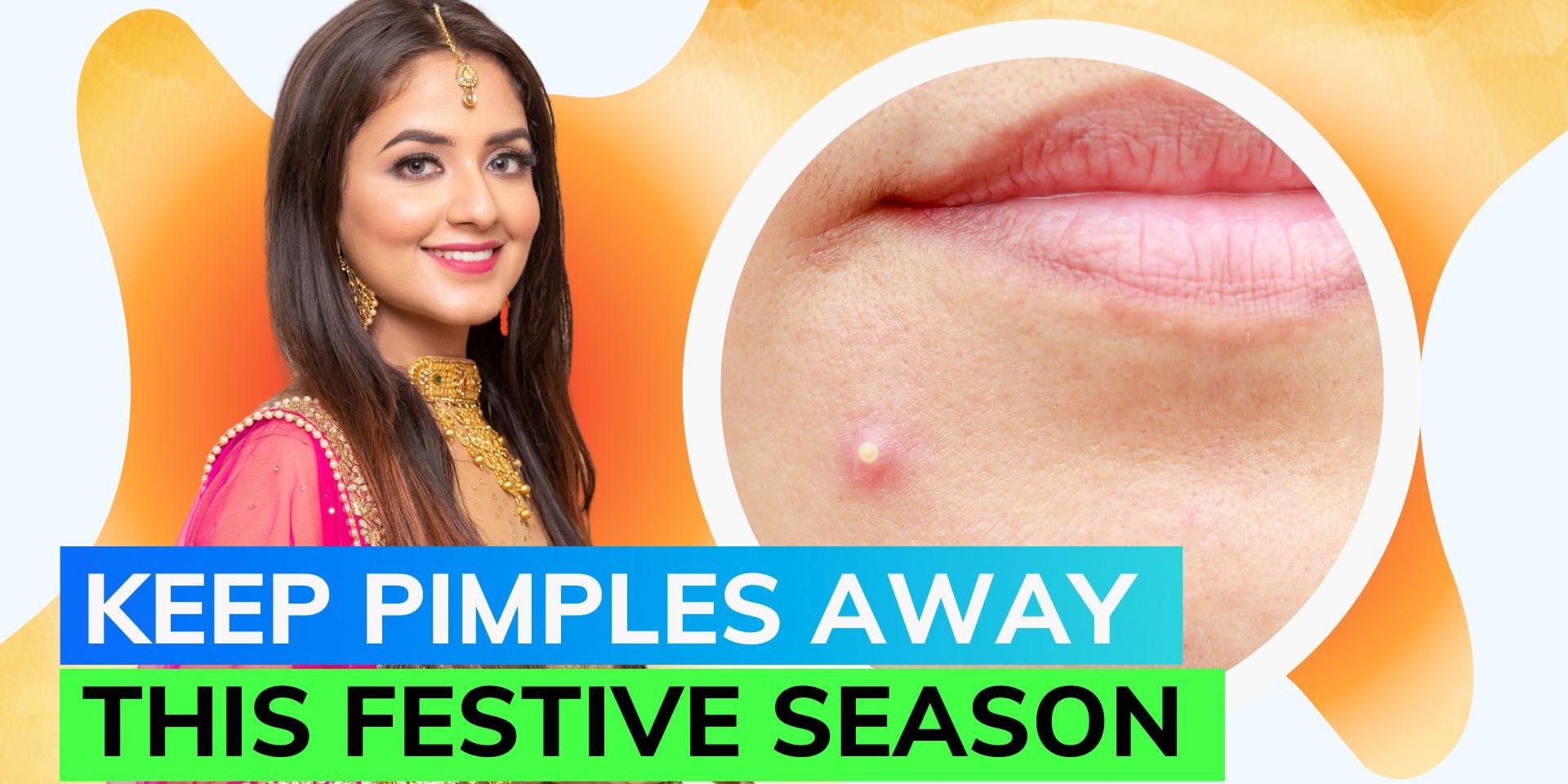 Festive skin SOS: Expert tips for pimple-free celebrations | Editorji