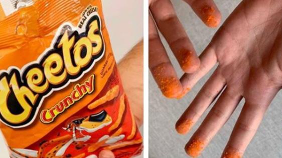 There's an official name for cheesy residue left after eating Cheetos ...