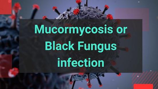 Mucormycosis: What is Black Fungus Infection that may cause blindness ...