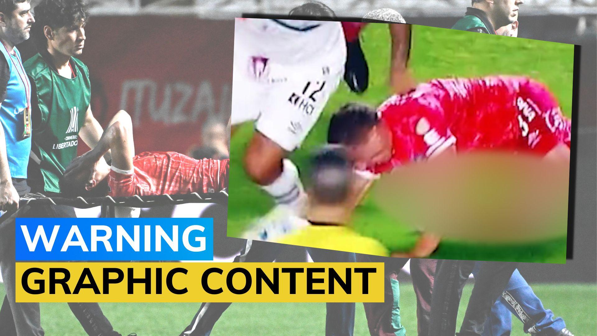 Watch: Former Real Madrid star Marcelo sent off in tears after horrible ...