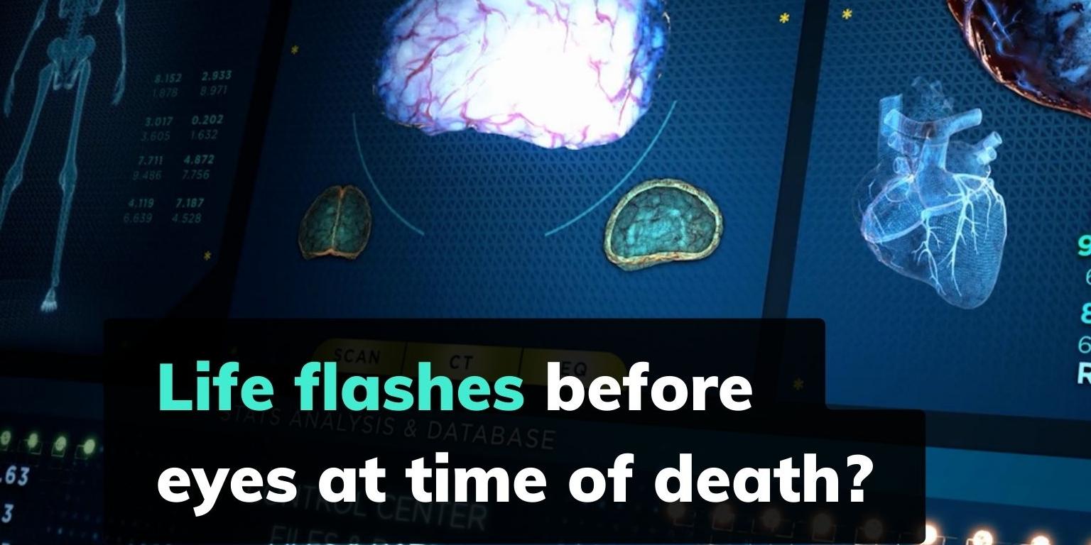 Man‘s death during brain wave recording leads to unique study: Life ...