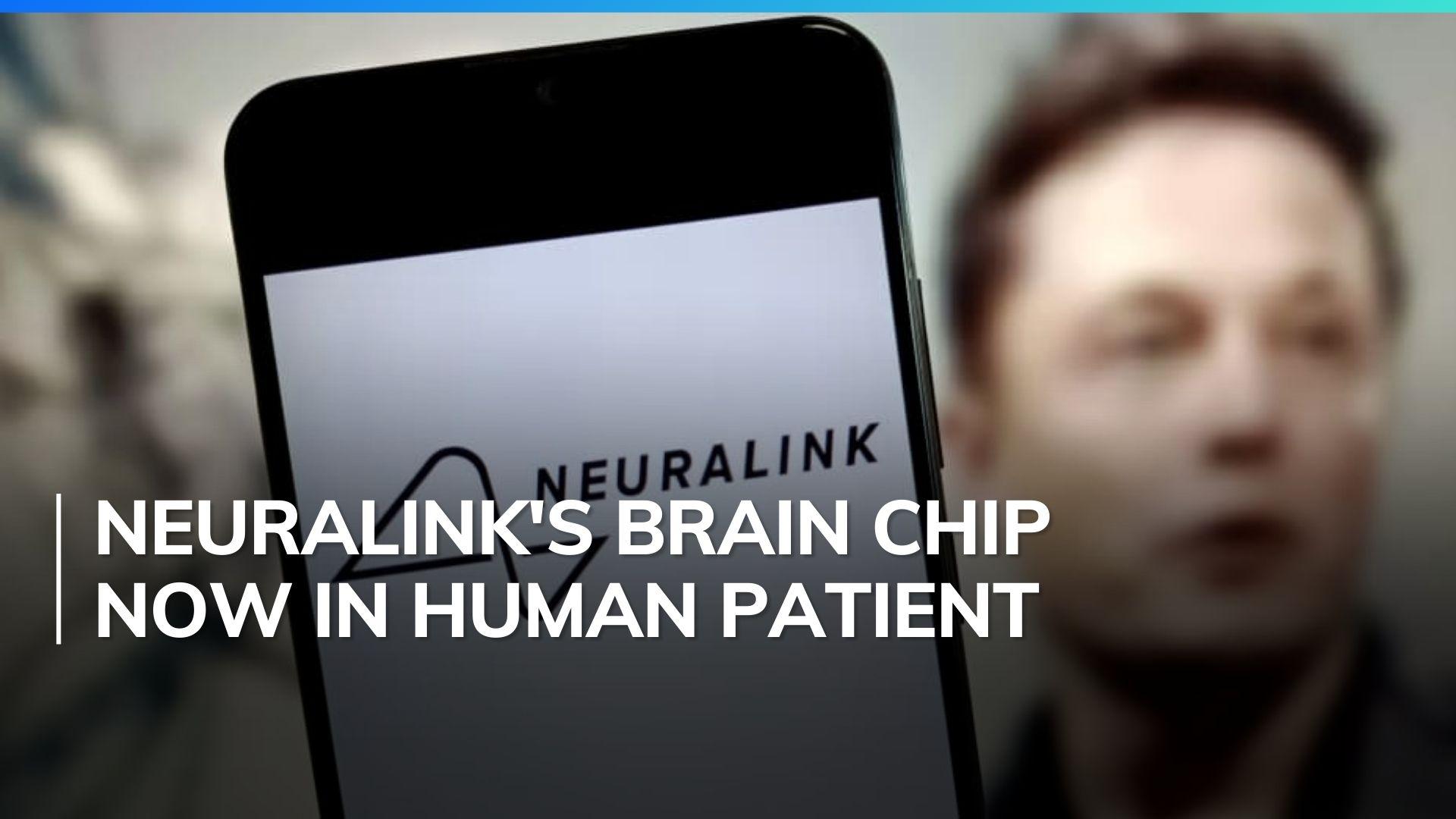 Elon Musk‘s Neuralink "Telepathy" Chip Successfully Implanted in First ...