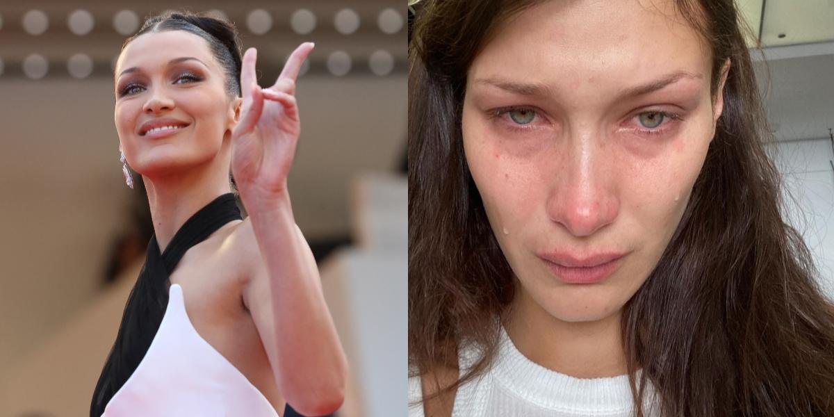 Bella Hadid opens up about her mental health struggles, says ‘social ...