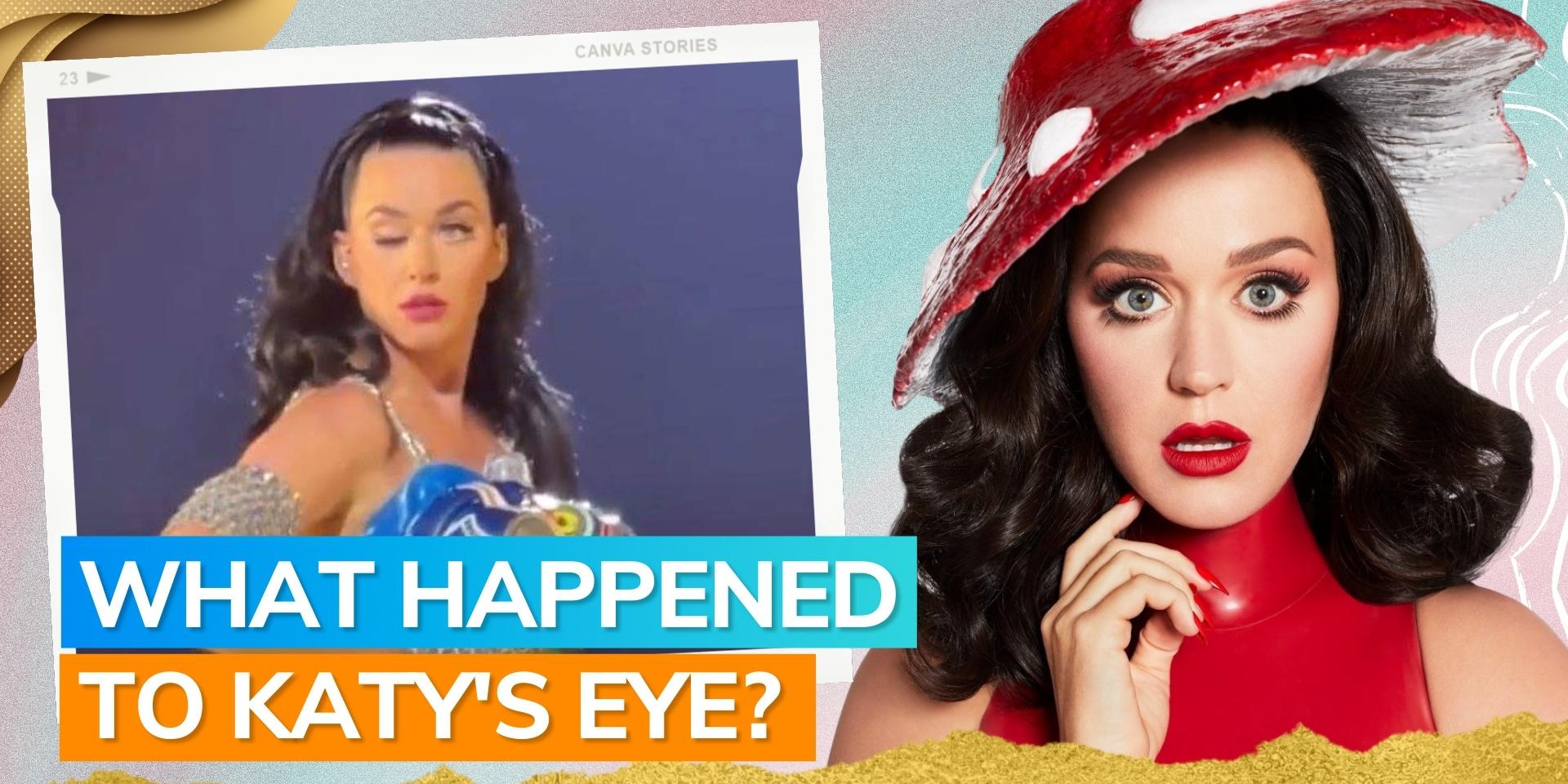 Fans express concern for Katy Perry after she suffers eye ...