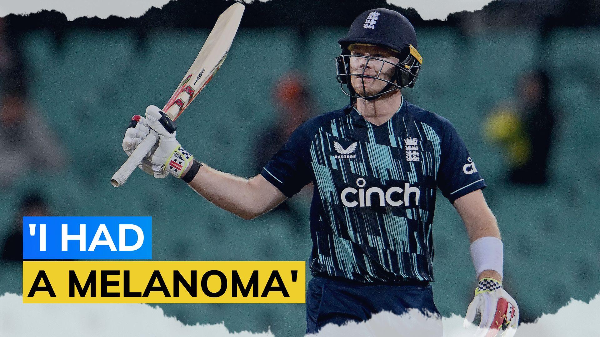 England cricketer Sam Billings opens up about his battle with skin ...