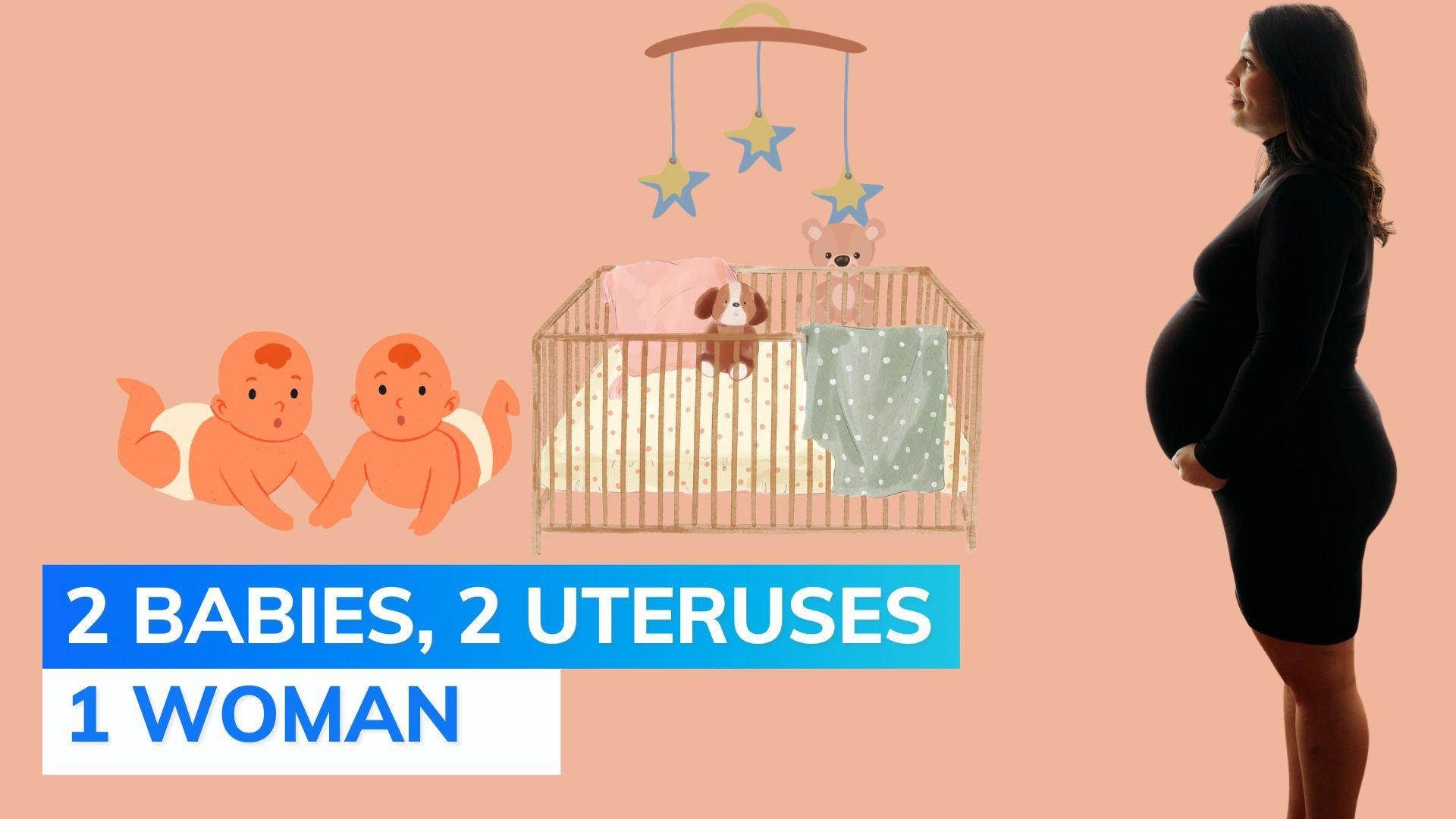 US woman pregnant with twins in two separate uteruses | Editorji