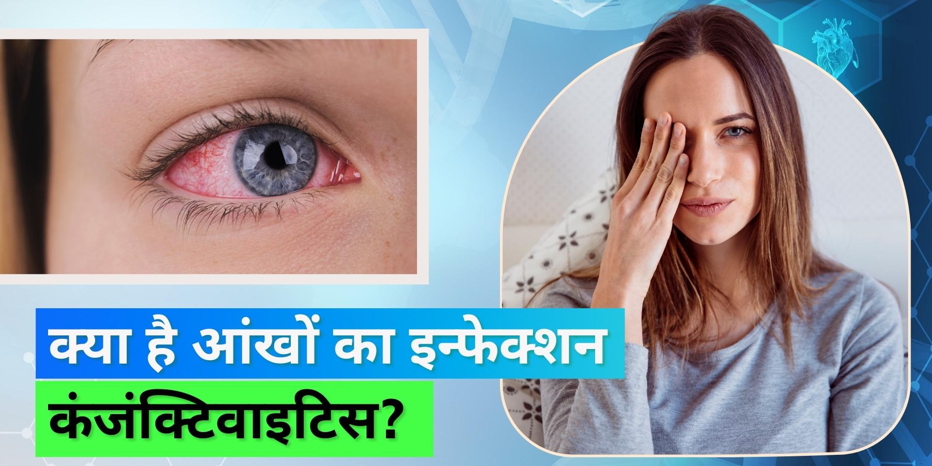As cases of conjunctivitis increase in Tamil Nadu, here are some ...
