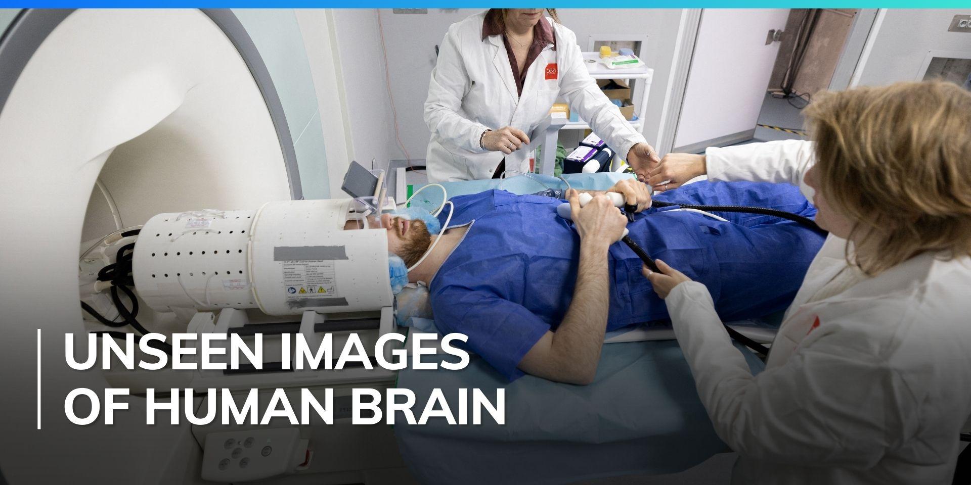 World‘s most powerful MRI scans first images of human brain | Watch ...