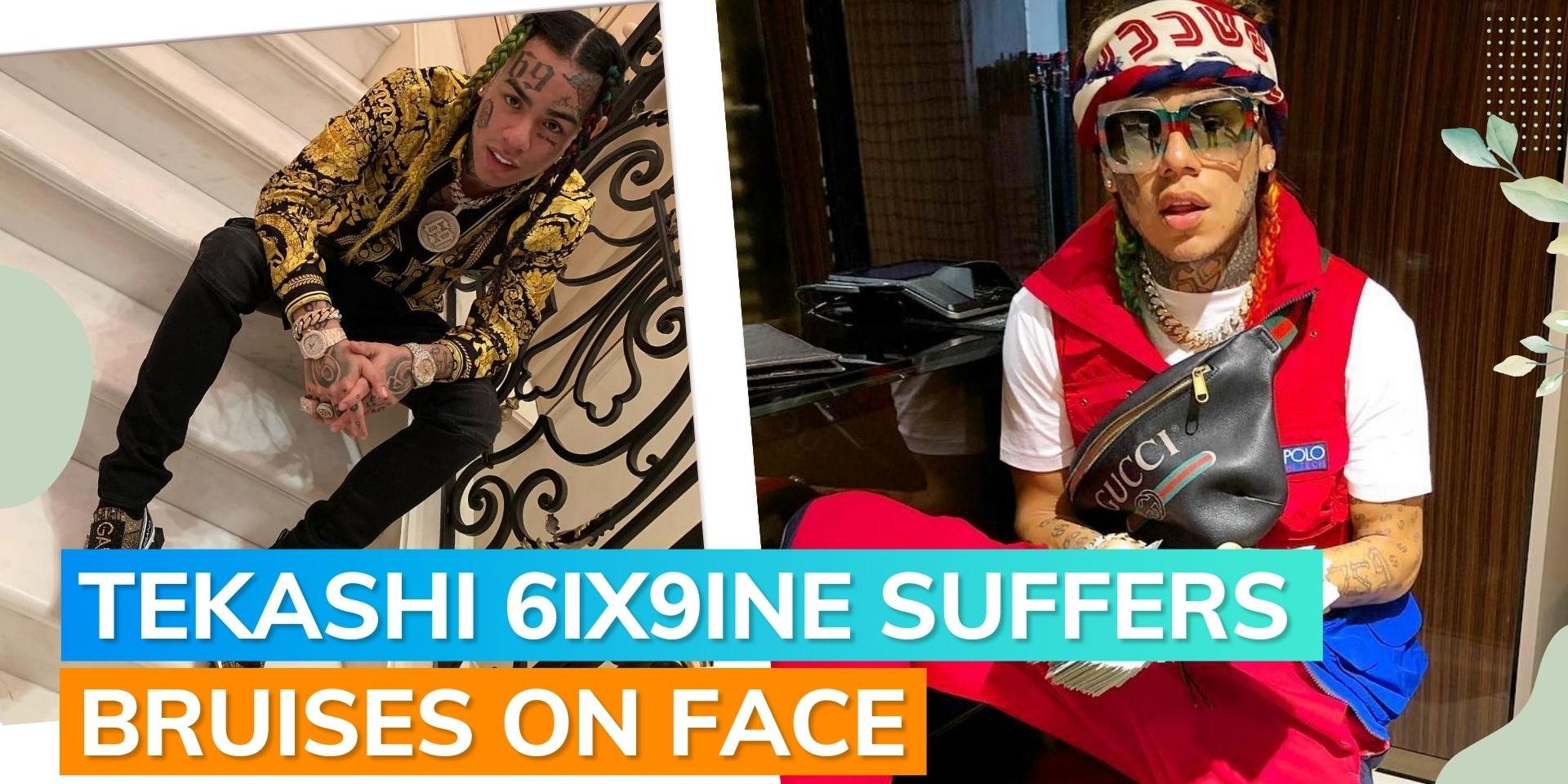 Rapper Tekashi 6ix9ine rushed to hospital after getting attacked inside ...