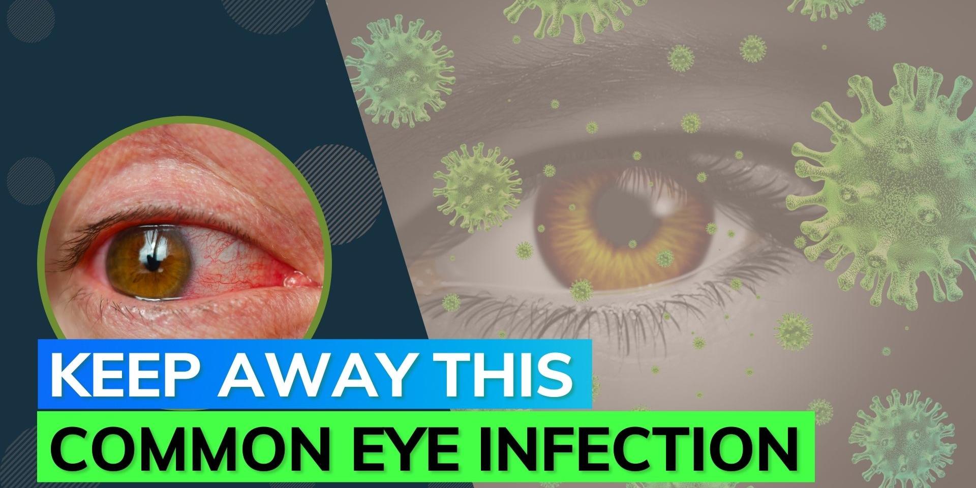 Monsoon Health: Conjunctivitis is a common eye infection during this ...