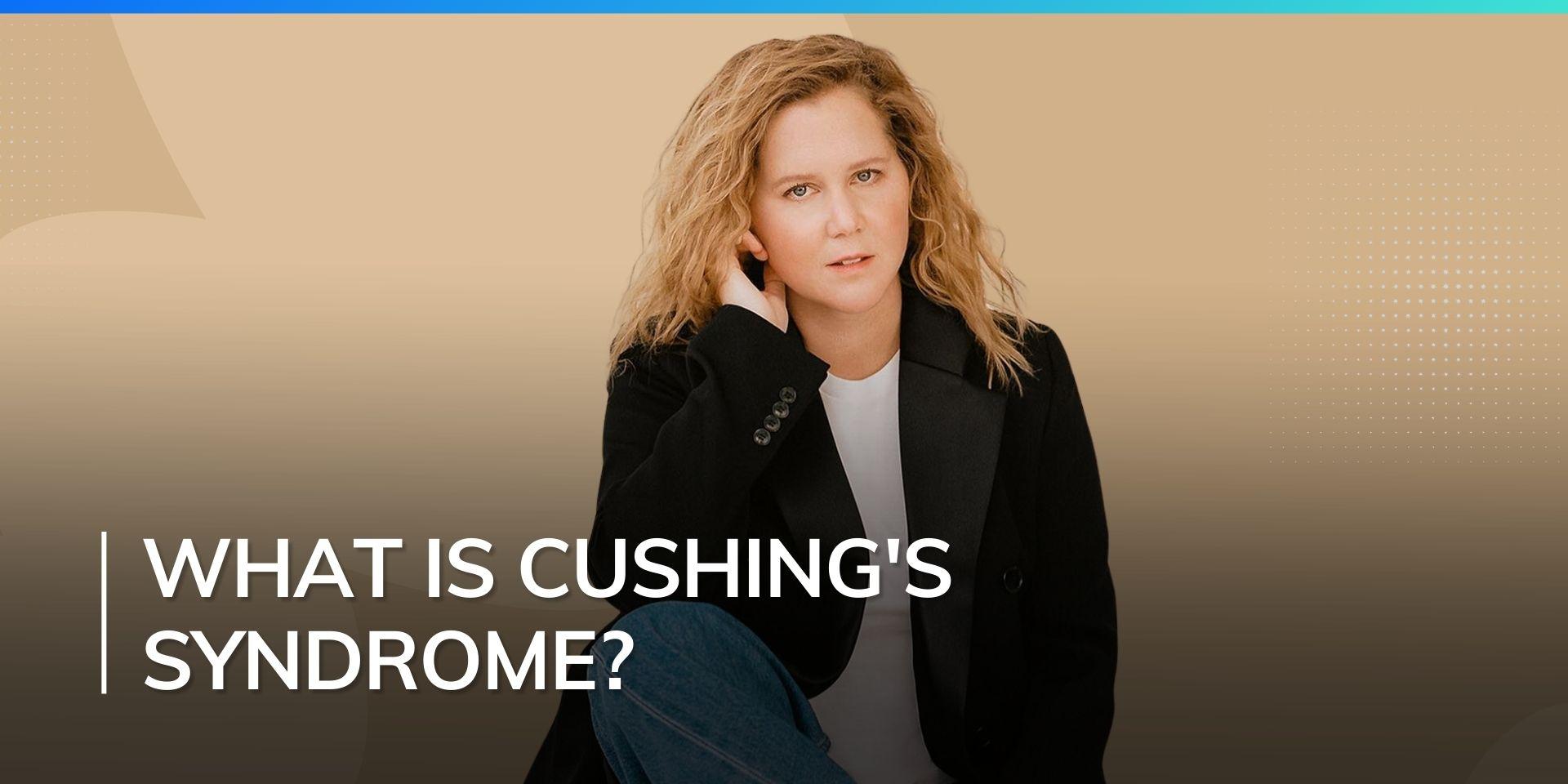 Trainwreck actor Amy Schumer diagnosed with Cushing‘s Syndrome; here is ...