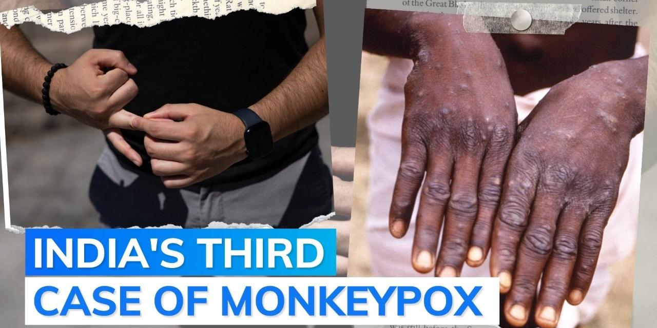 Kerala reports India‘s third Monkeypox case | Editorji