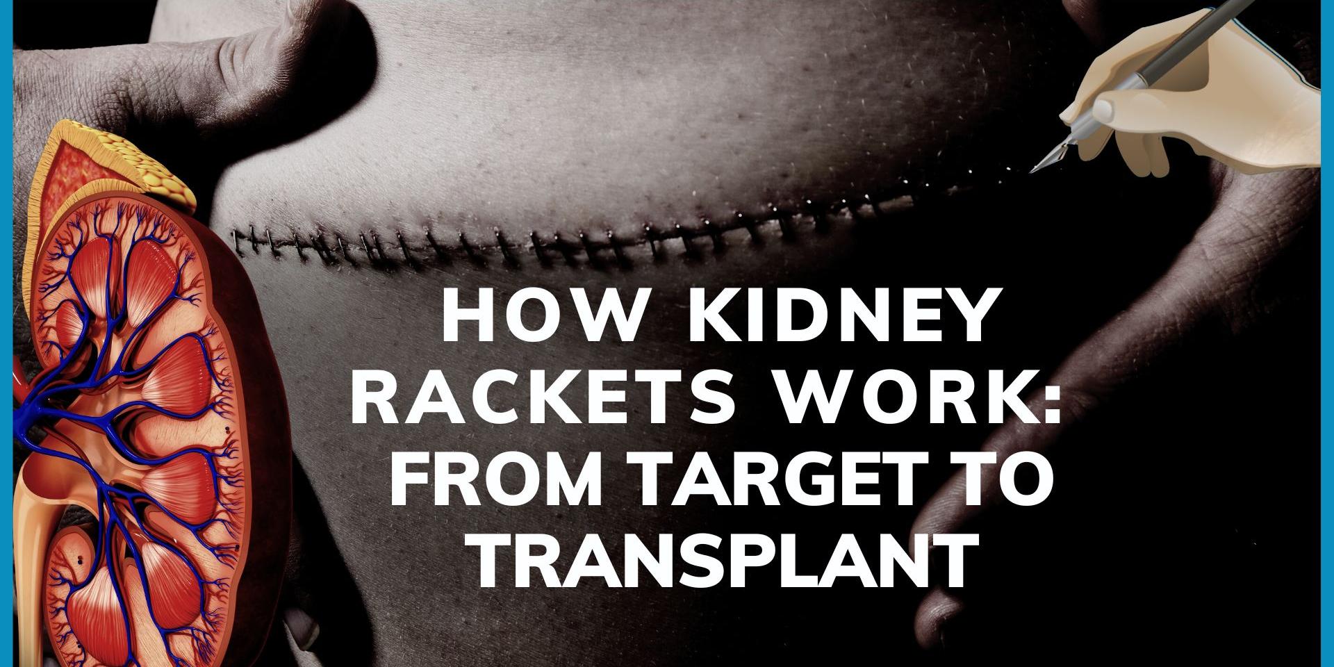 Another kidney racket uncovered: how gangs lure victims; why kidney ...