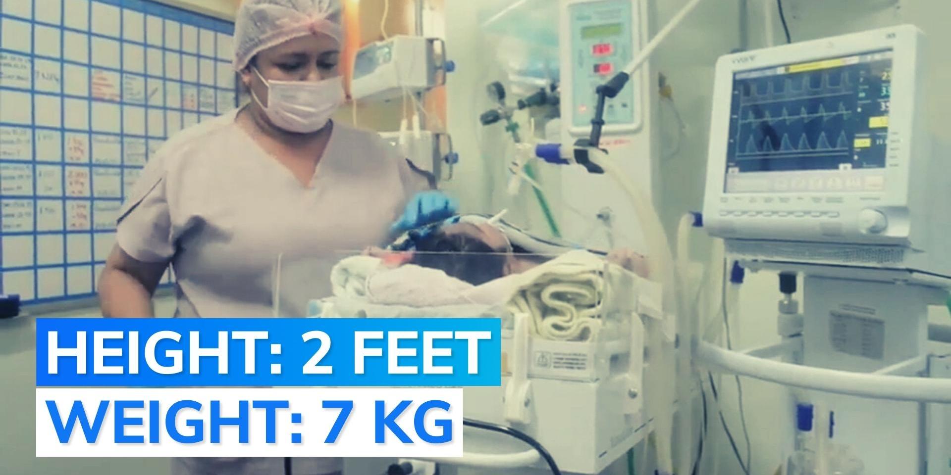 Over 7 kg-heavy baby born in Brazil. Here‘s what the ’giant baby ...