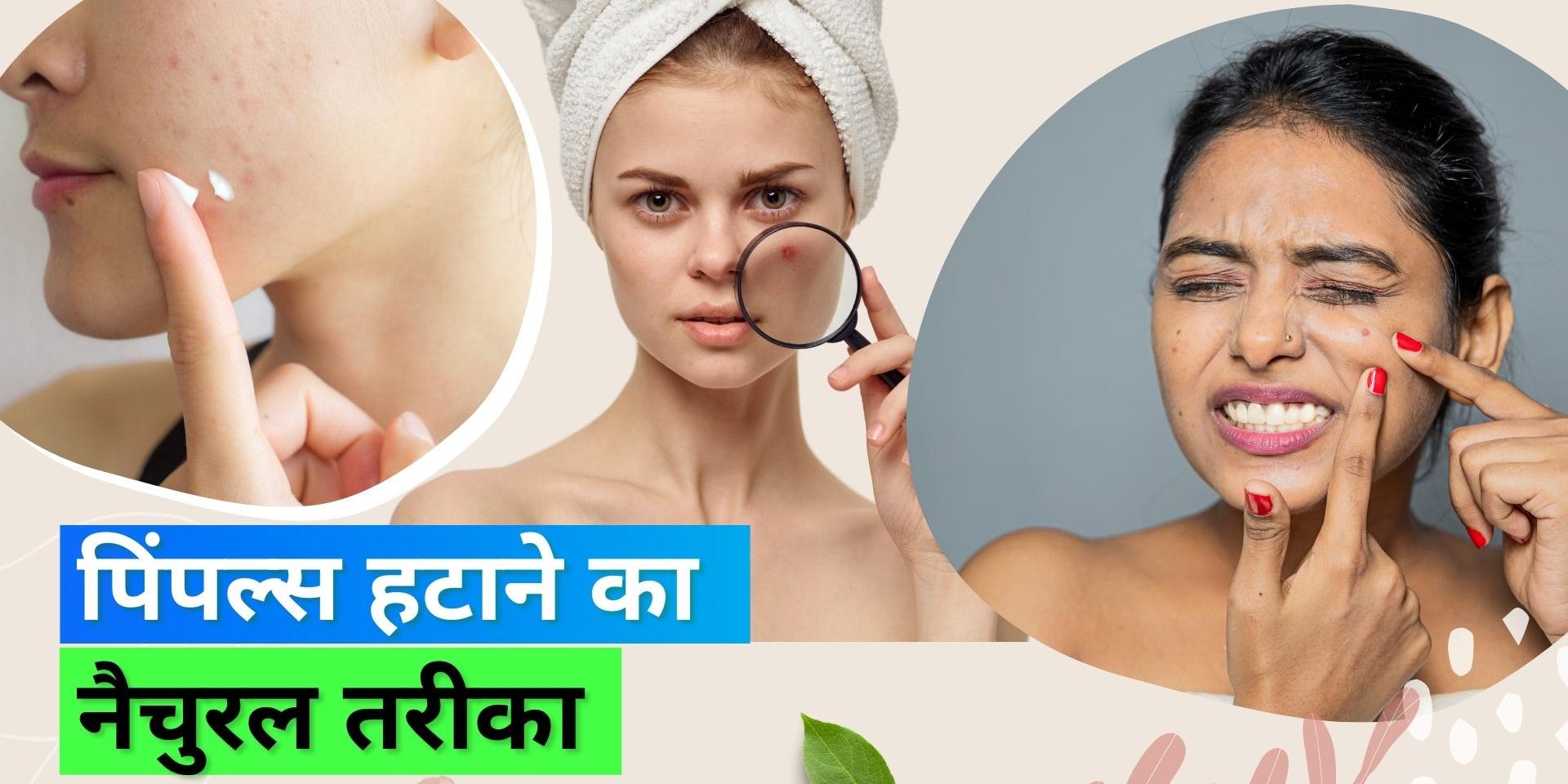 Now get rid of pimples overnight with this easy and natural remedy ...